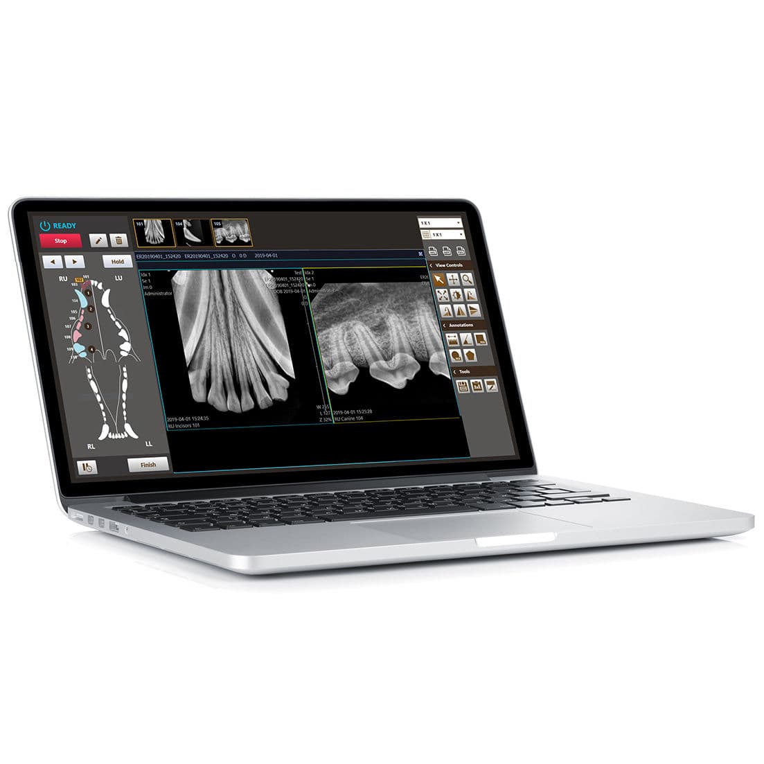 Программное обеспечение для обработки снимков зубов - MyVet Dent™ - my vet imaging ...